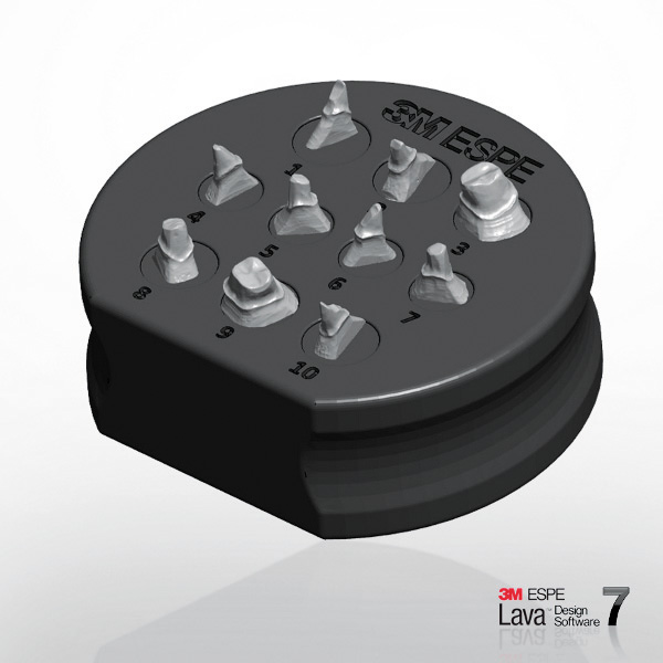 Neue Version des Lava(TM) Scan ST